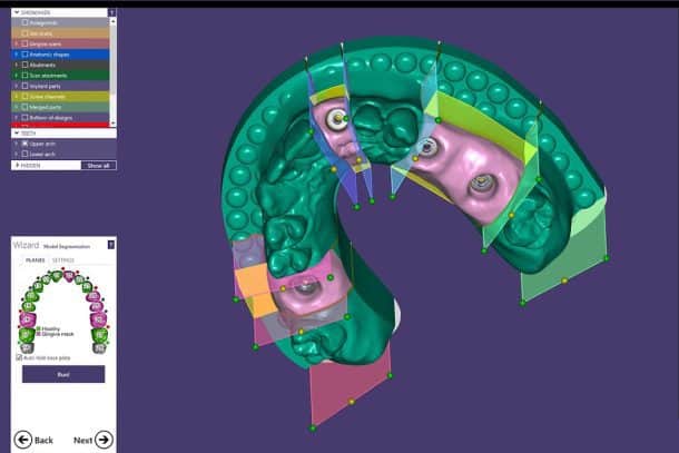 Digital Dental Services • Design • Production • 3D DDS