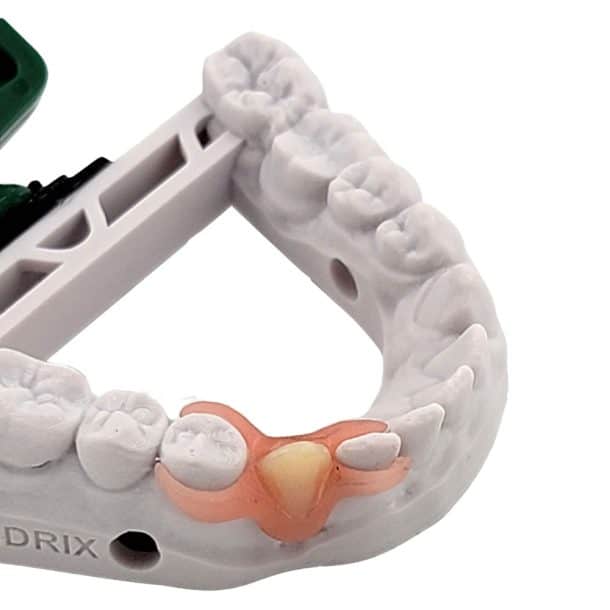 Partial Dentures • 3D DDS